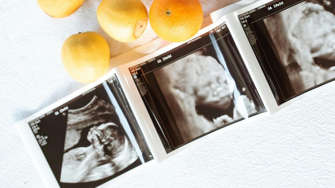 لوبريكف شراب للكحة (Loprecough) - مدونة الدواء