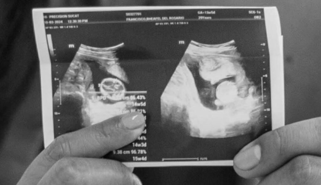 جاوتيلس اقراص لعلاج النقرس (Goutyless) - مدونة الدواء